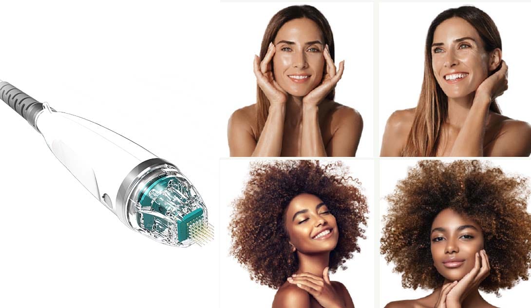 Secret Pro Skin Treatment Harley Street , London