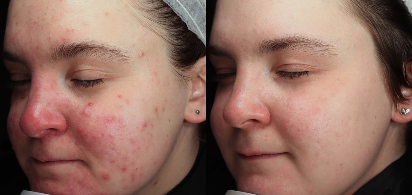 Self London - Dermatology, Laser and Lifestyle Clinic